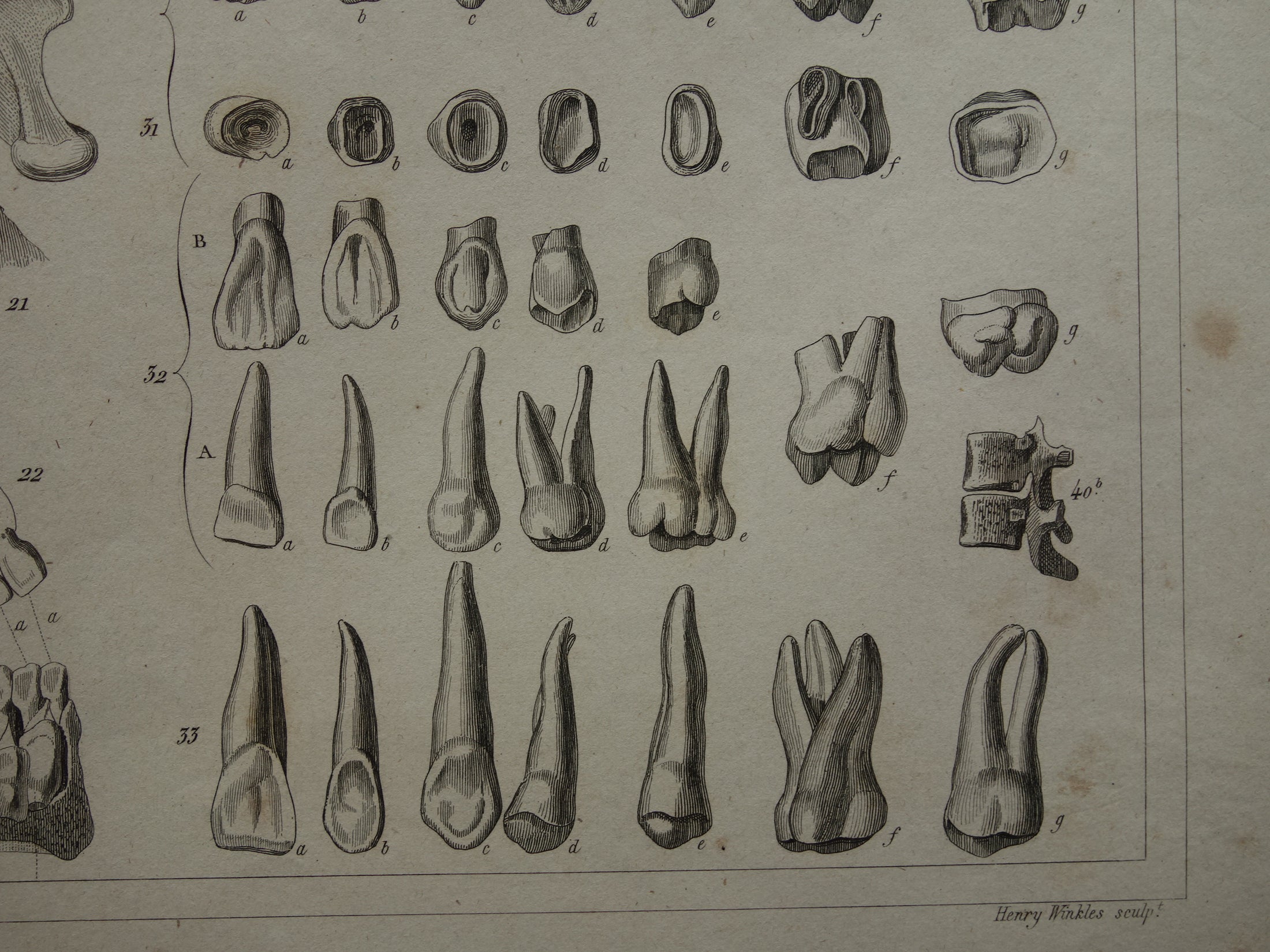 TANDEN oude anatomie print over Tand Kaak Gebit Antieke prent Vintage ...